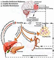 Leptin High Levels - Leptin Resistance